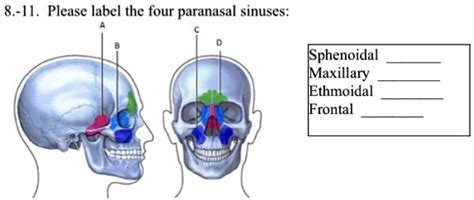 Solved 8 11please Label The Four Paranasal Sinuses Sphenoidal