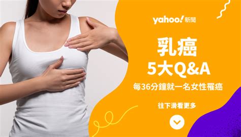 乳癌症狀有哪些？「婦女癌症發生率第一位」乳癌存活率高嗎？乳癌檢查怎麼做？