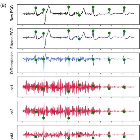 The Swt Process According To The Decomposition Levels The Ecg Record Download Scientific