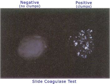 The Coagulase Test