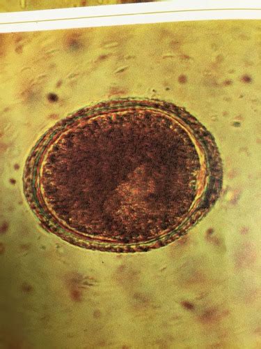Large Roundworm Eggs Flashcards Quizlet