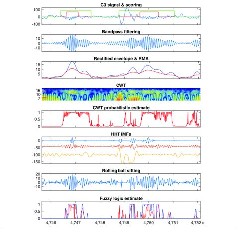 Frequency Based Sleep Spindle Detection An Example C3 Signal Data 1 Download Scientific
