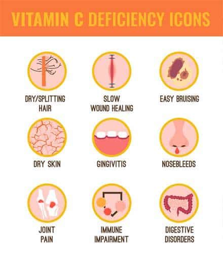 Vitamin C Deficiency Bones