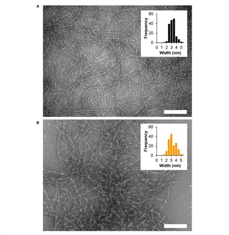 Tem Micrographs Showing Fibrils Isolated From 1 Wt Fibrillar Gel