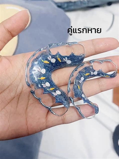 อุทาหรณ์ คนจัดฟันกับรีเทนเนอร์เจ้าปัญหา⁉️ แกลเลอรีที่โพสต์โดย ᴥ บ้านเจ้าออม ꔛ Lemon8