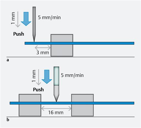 Measurement Of Flexibility And Stiffness At The Guidewire Tip The Download Scientific Diagram