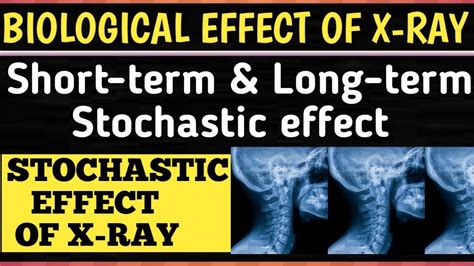 Short Term And Long Term Stochastic Effects What Is The Stochastic Effect Of X Ray In Hindi