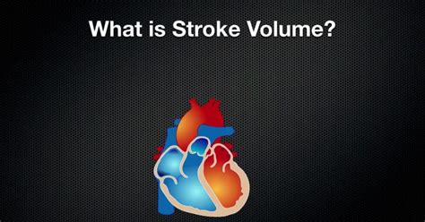 Useful Guideline To Calculating Stroke Volume Qd Nurses