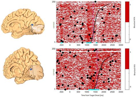 Binarized Electrodes In The Right Extrastriate Visual Cortex During The Download Scientific