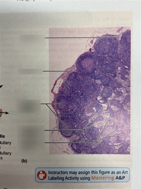 Structure Of A Lymph Node Microscopic View Diagram Quizlet