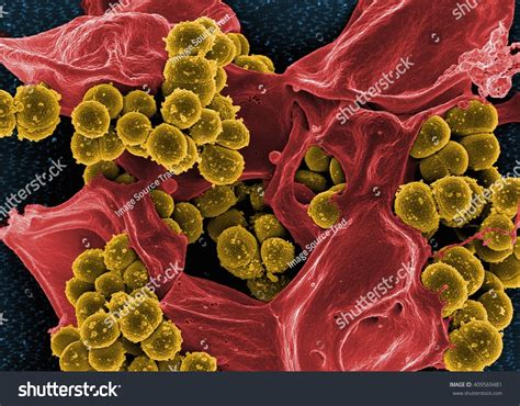Colorized Sem Methicillinresistant Staphylococcus Aureus Mrsa Foto Stock 409569481 Shutterstock
