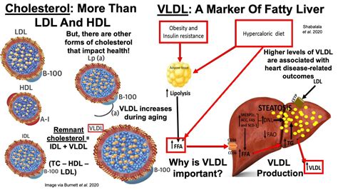 Vldl Increases During Aging And Is Associated With Adverse