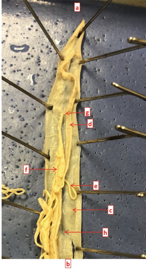 Lab 21 Nematoda Diagram Quizlet