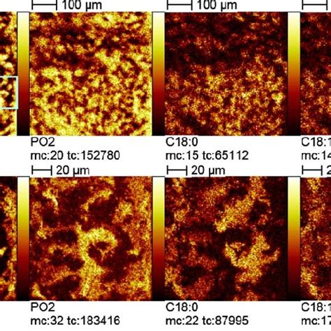 Pdf Chemical Analysis Of Osmium Tetroxide Staining In Adipose Tissue Using Imaging Tof Sims