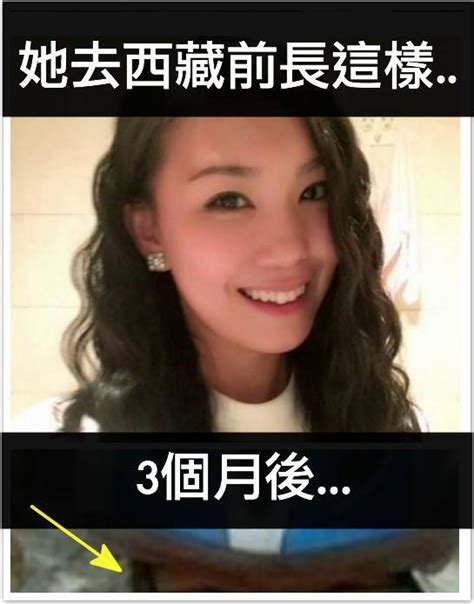 嚇傻！美女去完西藏後變這樣如果做好防曬就好了！