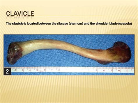 Attribution Of Sex Through Thorax Ribs Sternum Pelvis Ppt