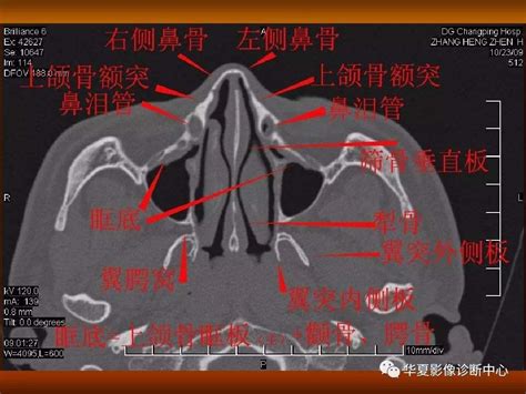 颌面部ct断层解剖 图库 五毛网
