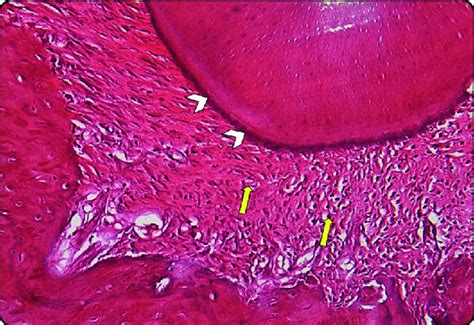A Photomicrograph Of Control Group Showing Apical Group Of Periodontal