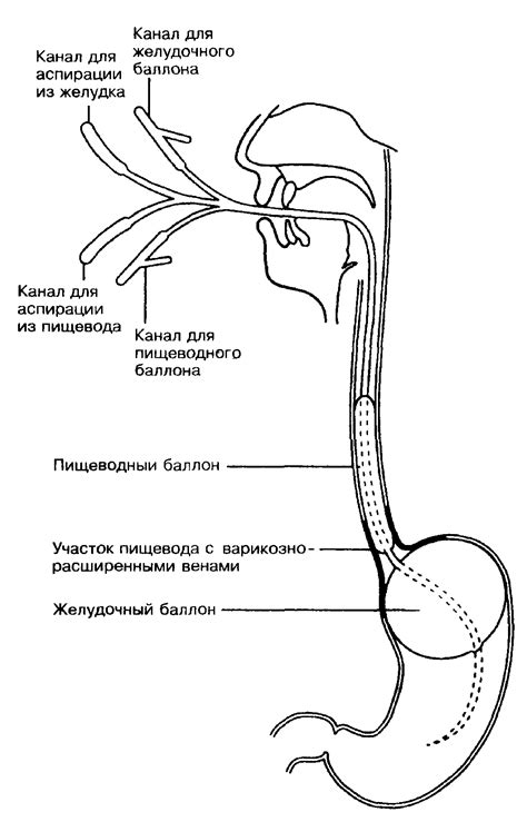 Пункция перикарда
