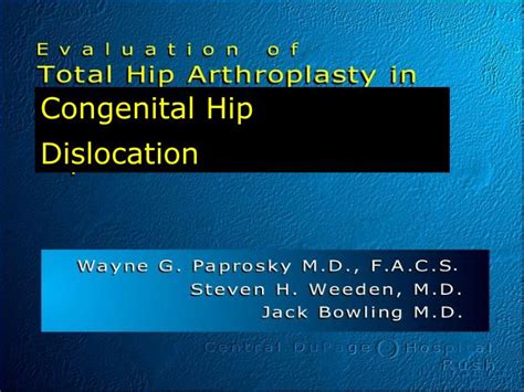 Ppt Congenital Hip Dislocation Powerpoint Presentation Free Download