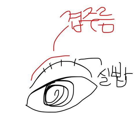 의사에게 물어보세요 어제 절개로 쌍수를 강남언니 1등 성형수술and피부시술 정보앱