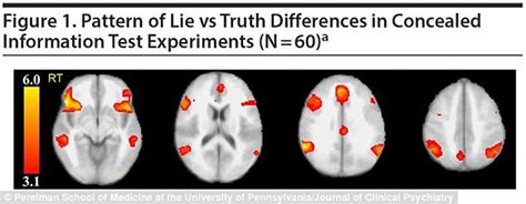Fmri Scans Better Than A Polygraph In Lie Detection — Oakland Mri