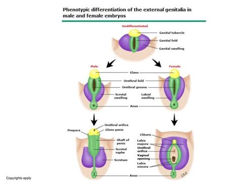 Disorder Of Sex Differentiation Presentation Pdf