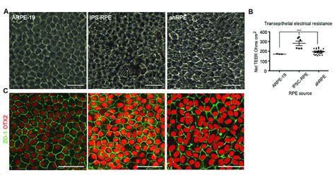 Phenotypic Comparison Between Different Sources Of Rpe A Phase
