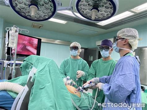 男罹罕見肝結石從上腹痛到後背 3d腹腔鏡微創肝切除術治癒 Ettoday健康雲 Ettoday新聞雲