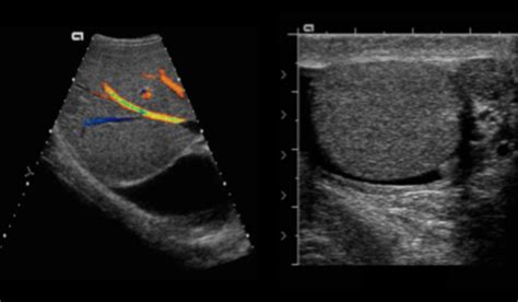 Transducer Arrays Sequencing And Phasing Flashcards Quizlet