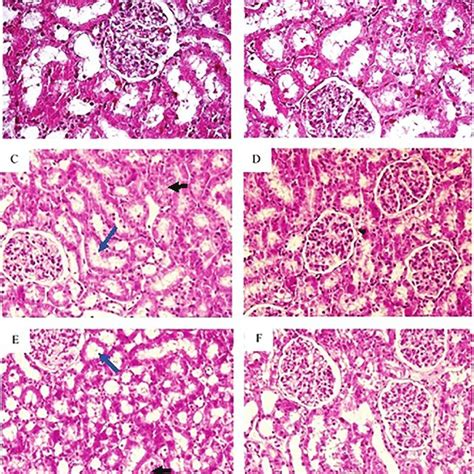 The Effect Of Sex Differences And A High Dose Of Lps Injection After Download Scientific
