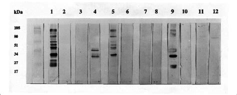 Figure Western Blot Of Toxoplasma Gondii Or Neospora Caninum Antigen Download Scientific