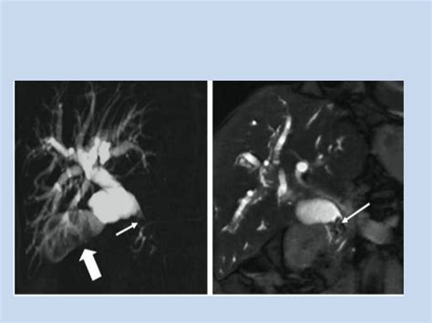 Mrcp Radiology Pptx