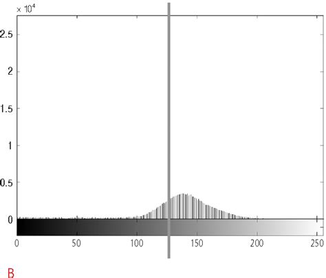 Figure 1 From Computer Aided Detection System For Masses In Automated Whole Breast