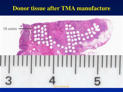 Ppt Requirements For Good Tissue Microarray Tma Results Powerpoint