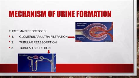 Understanding Urinalysispptx