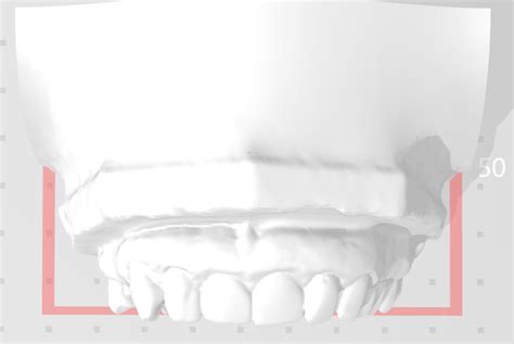 Windows Pymeshlab Surfacereconstructionscreenedpoisson · Issue