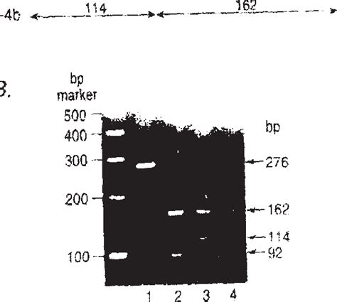 Figure 2 From A Modified Pcr Rflp Genotyping Method Demonstrates The Presence Of The Hpa 4b