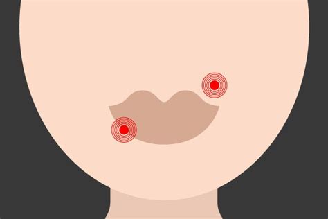 Herpes STD Disclosure Porn Sex Habits