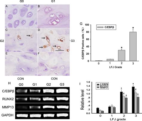 Expression Levels Of Cebpβ And Runx2 Were Upregulated In Human Lfj