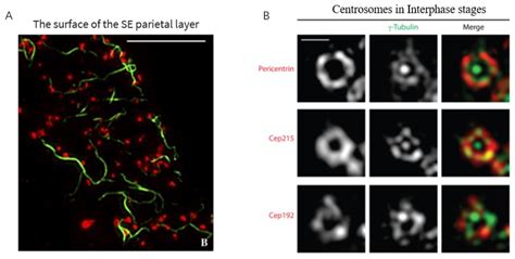 Structured Illumination Microscopy Service Creative Biostructure