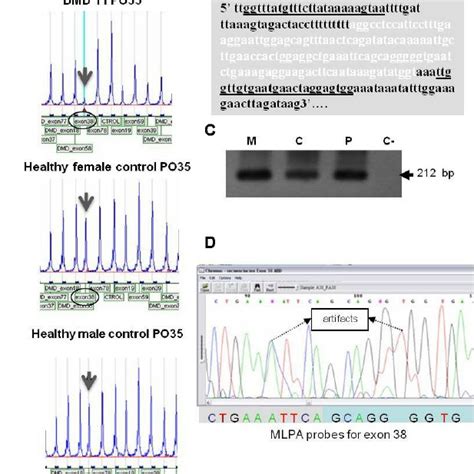 Multiplex Ligation Dependent Probe Amplification Mlpa Polymerase Download Scientific Diagram