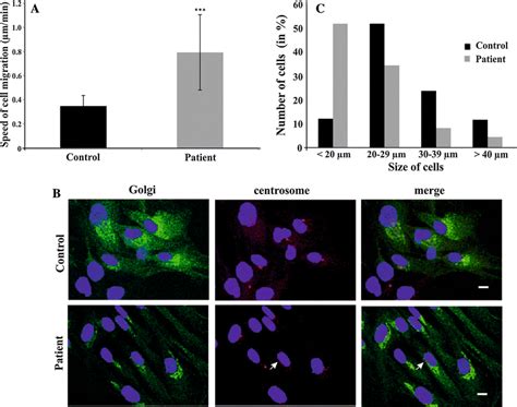 Cell Migration Cell Polarity And Cell Size Analysis A Analysis Of Download Scientific Diagram