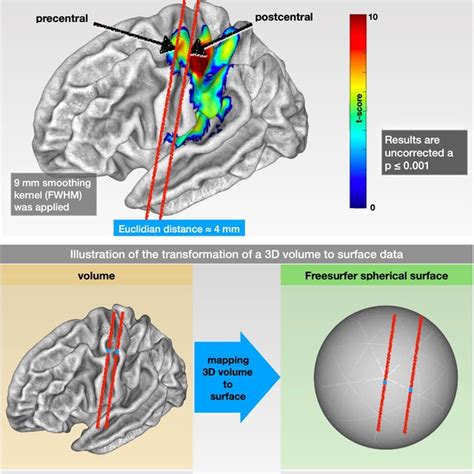 Comparing Cortical Activation Patterns In Specific Brain Regions Of
