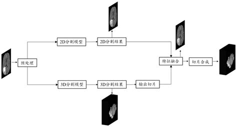 一种多模态医学图像分割方法