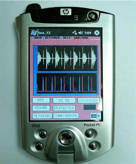Heart Sound Signal Segmentation Download Scientific Diagram