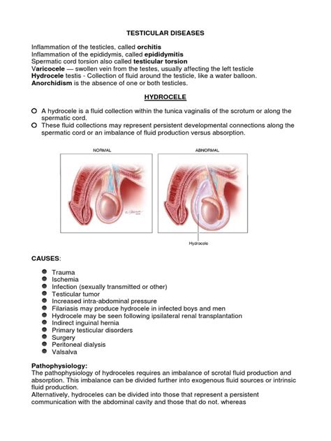 Testicular Diseases Orchitis Epididymitis Testicular Torsion Aricocele