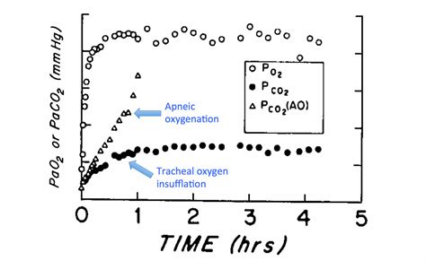 High Flow Nasal Cannula For Apneic Oxyventilation
