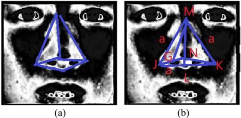 Nose Component Area Is Super Imposed With Pyramid Structure A Sample