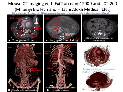 Ppt Ct Contrast Agents Module 3 Powerpoint Presentation Free